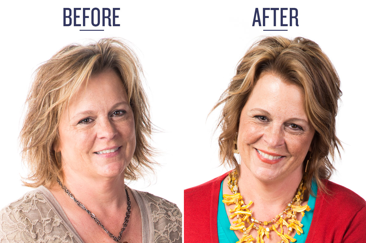 A Dynamic Before & After for a Woman Over 40