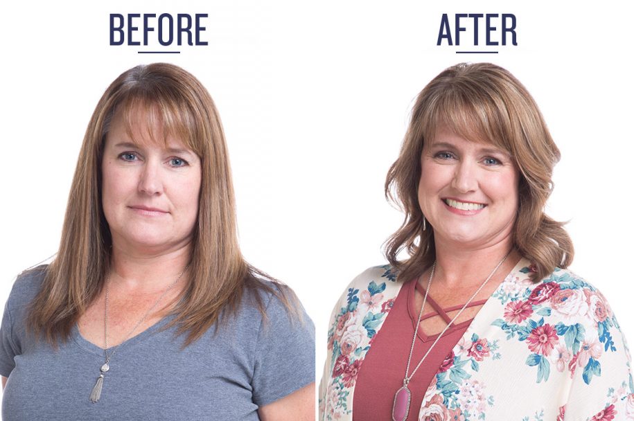 A Dynamic Before & After for a Woman Over 40