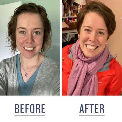 Think You’re a Type 2? You Could Be Wrong! (Here’s Why So Many Women Are)