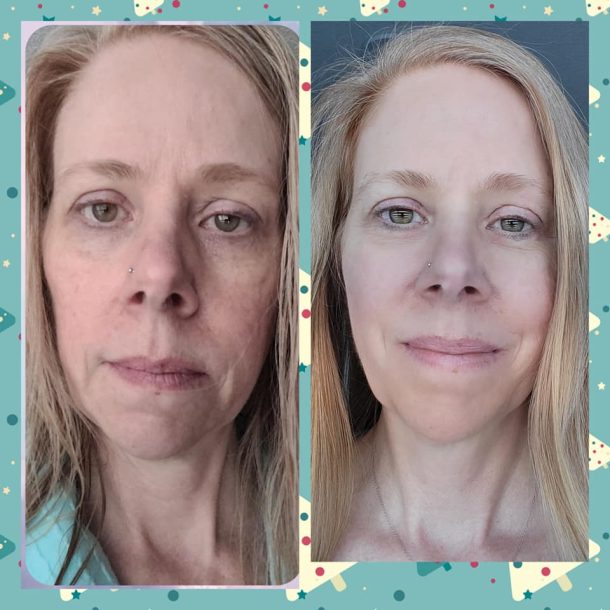 Is Your Neck Revealing Your Age? #1 Way to Reverse This (Photos Inside!)