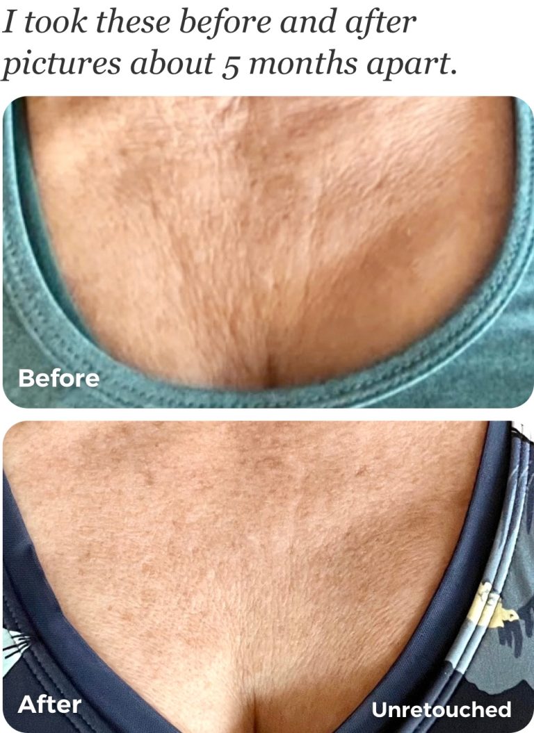 Transform Aging Body Skin: Discover Our Solution